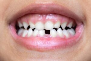 All you need to know about baby teeth. - Smile Circle Blog